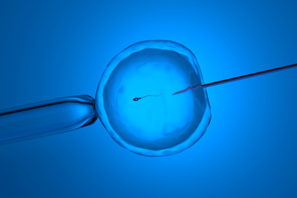 Nova técnica de FIV com 3 pessoas poupa bebês de doenças hereditárias ...